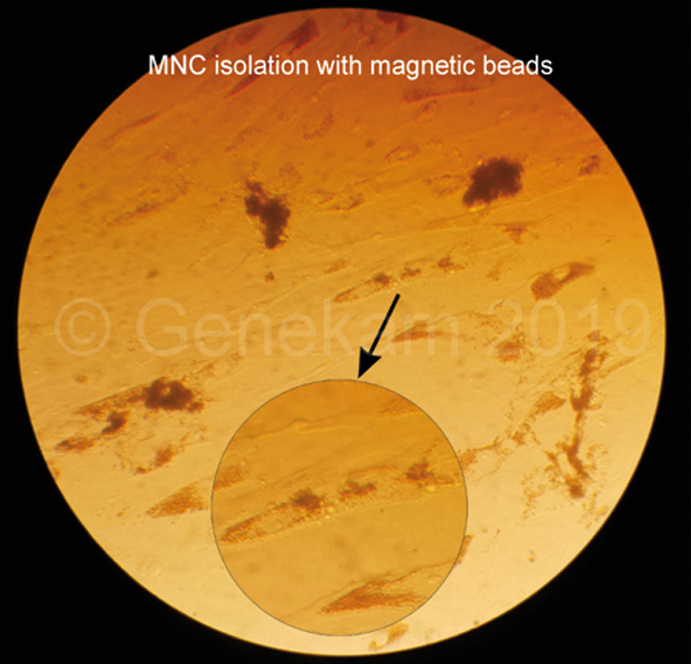 A simple method for isolation of rest of trypsinized stem cells with ...
